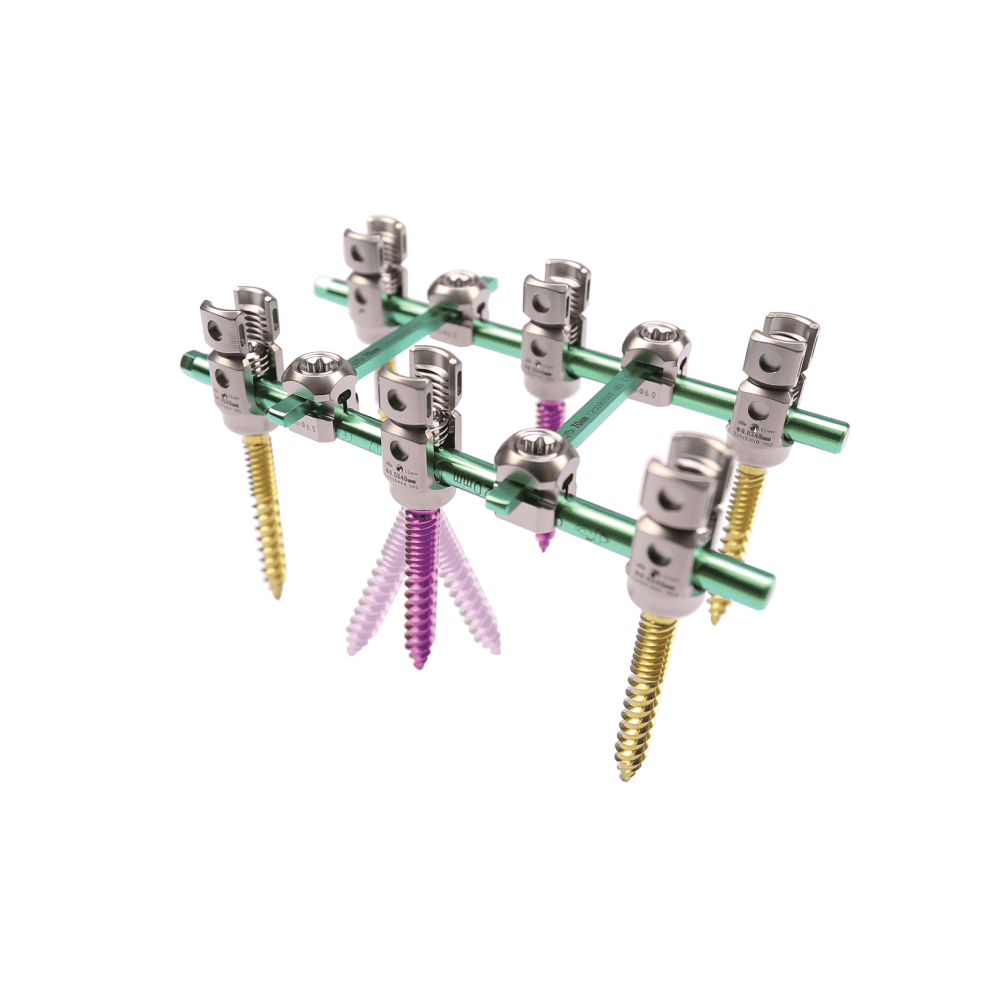 JZPA 6.0 Spinal Fixation System • Kangli Orthopedics